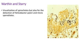 STAINS IN HISTOPATHOLOGY.pptx