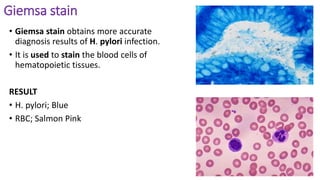 STAINS IN HISTOPATHOLOGY.pptx