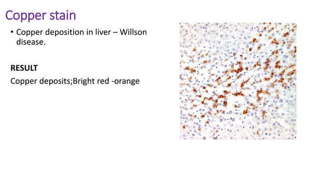 STAINS IN HISTOPATHOLOGY.pptx