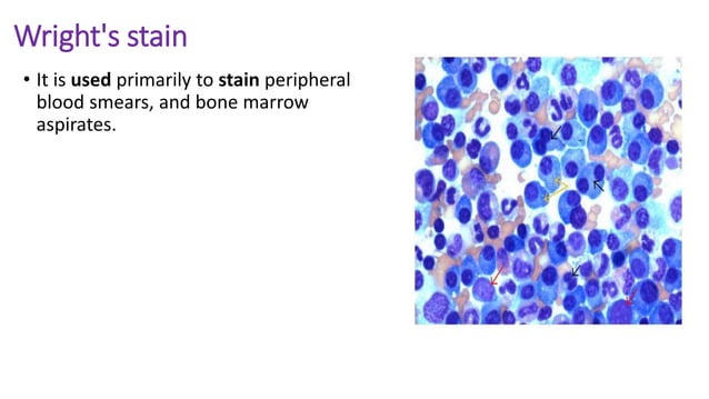 STAINS IN HISTOPATHOLOGY.pptx