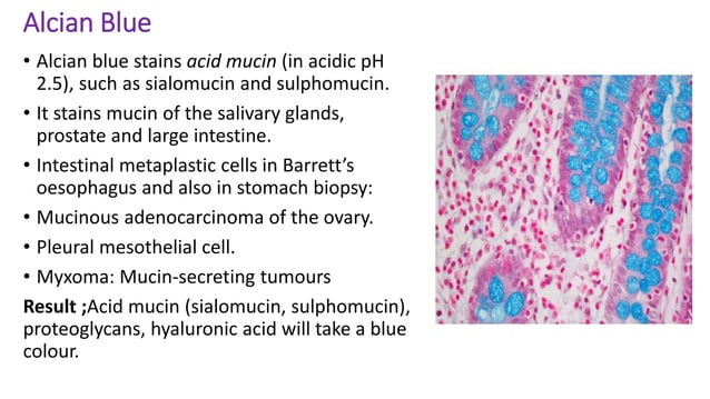 STAINS IN HISTOPATHOLOGY.pptx
