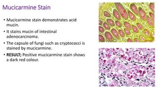 STAINS IN HISTOPATHOLOGY.pptx