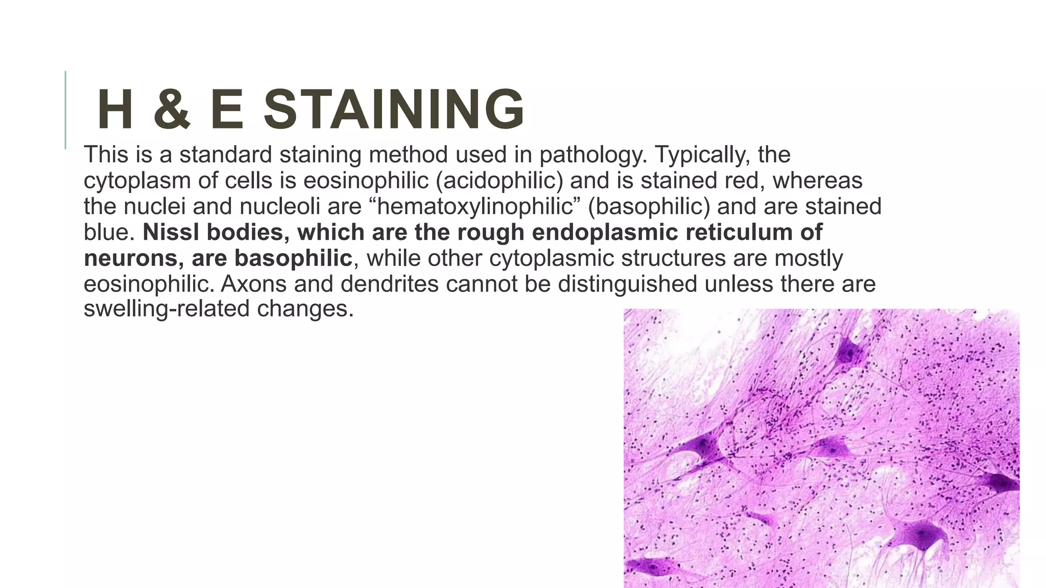 stains of nervous tissues.pptx