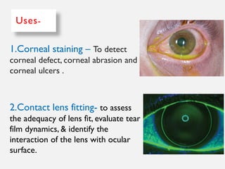 Dyes/ Stain Used In Ophthalmology - Clinical uses, Indication & Side ...