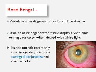 Dyes/ Stain Used In Ophthalmology - Clinical uses, Indication & Side ...