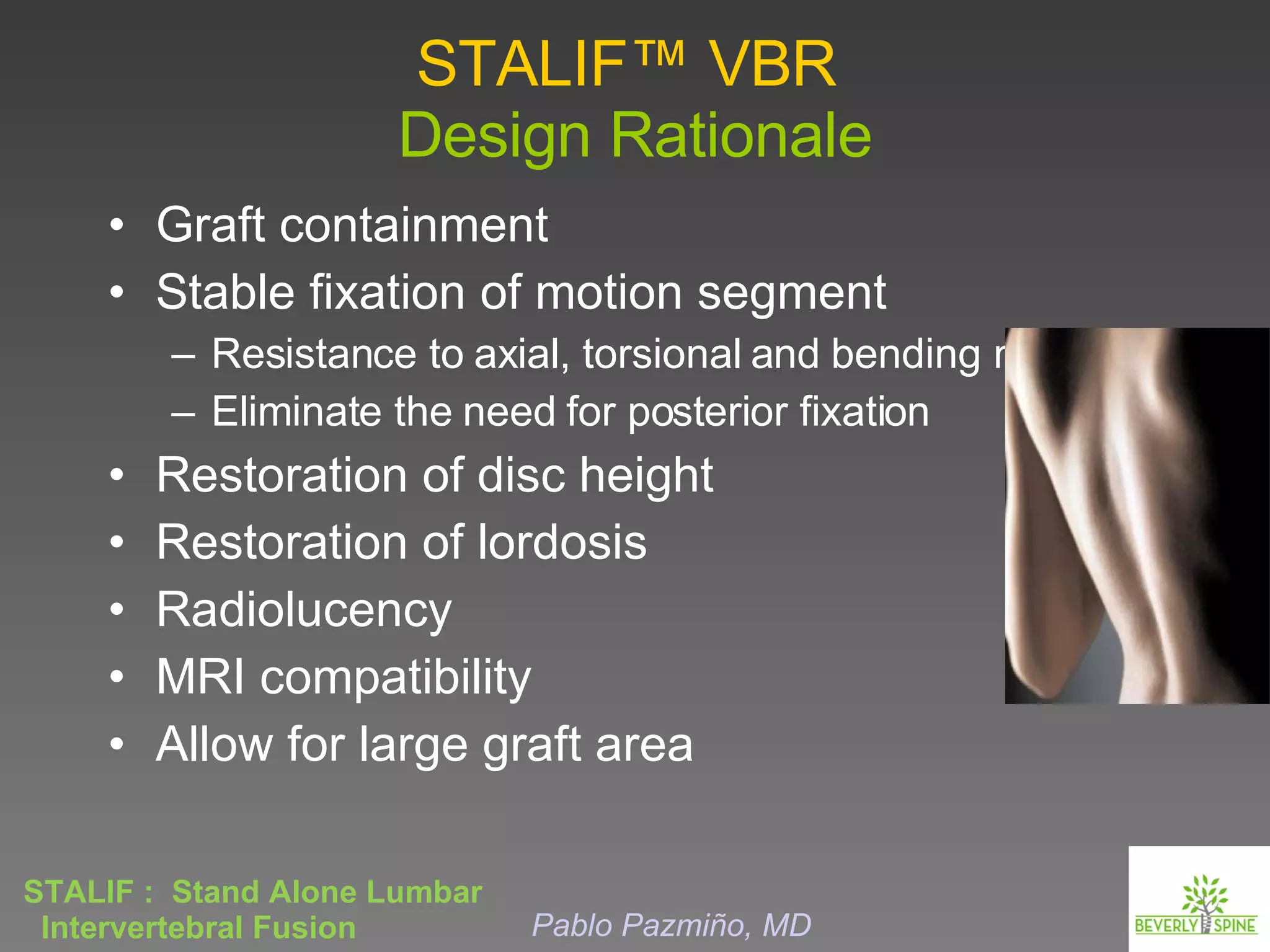 Lumbar Fusion : A New Anterior Only Option. The STALIF | PPT