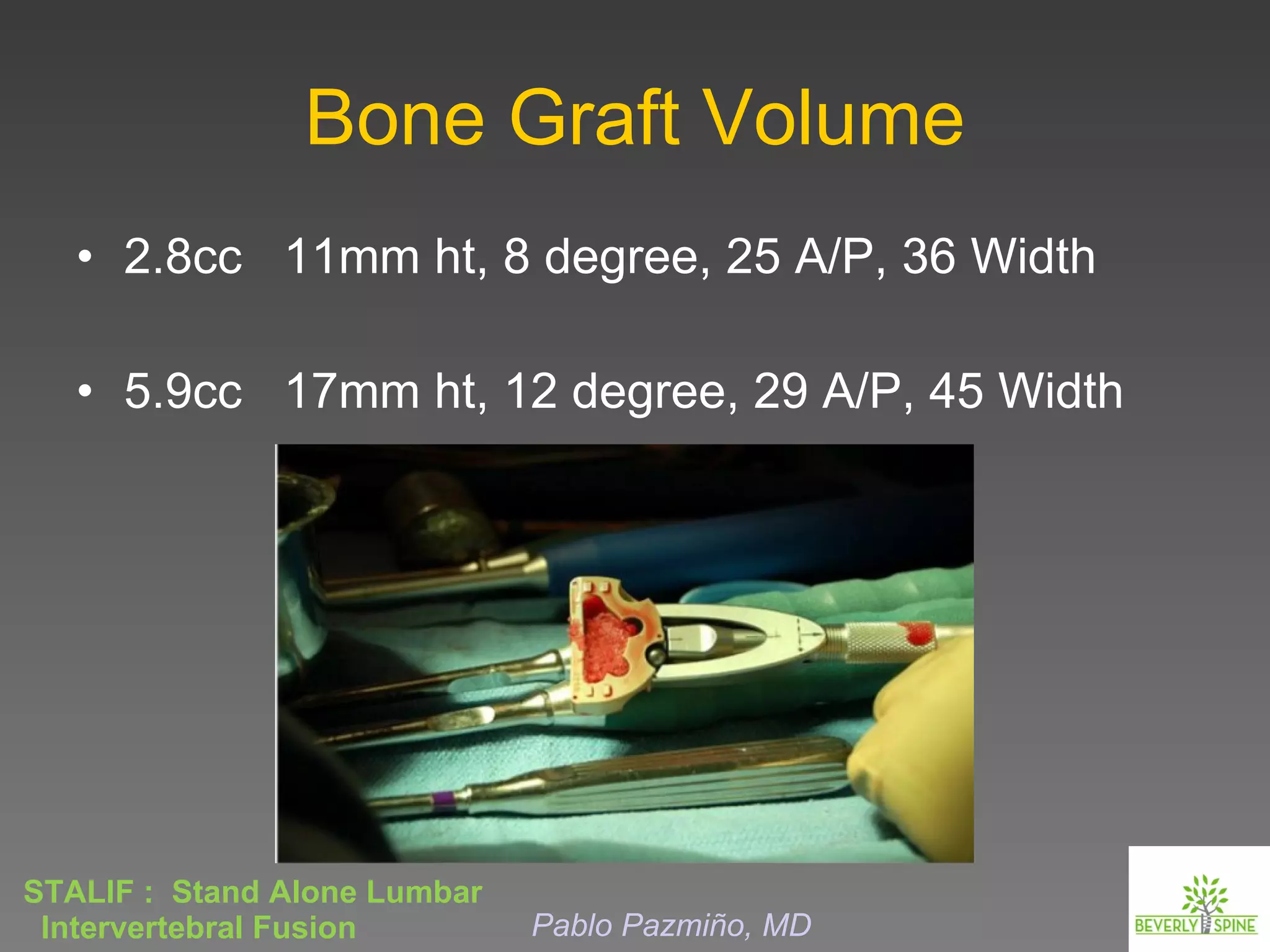 Lumbar Fusion : A New Anterior Only Option. The STALIF | PPT