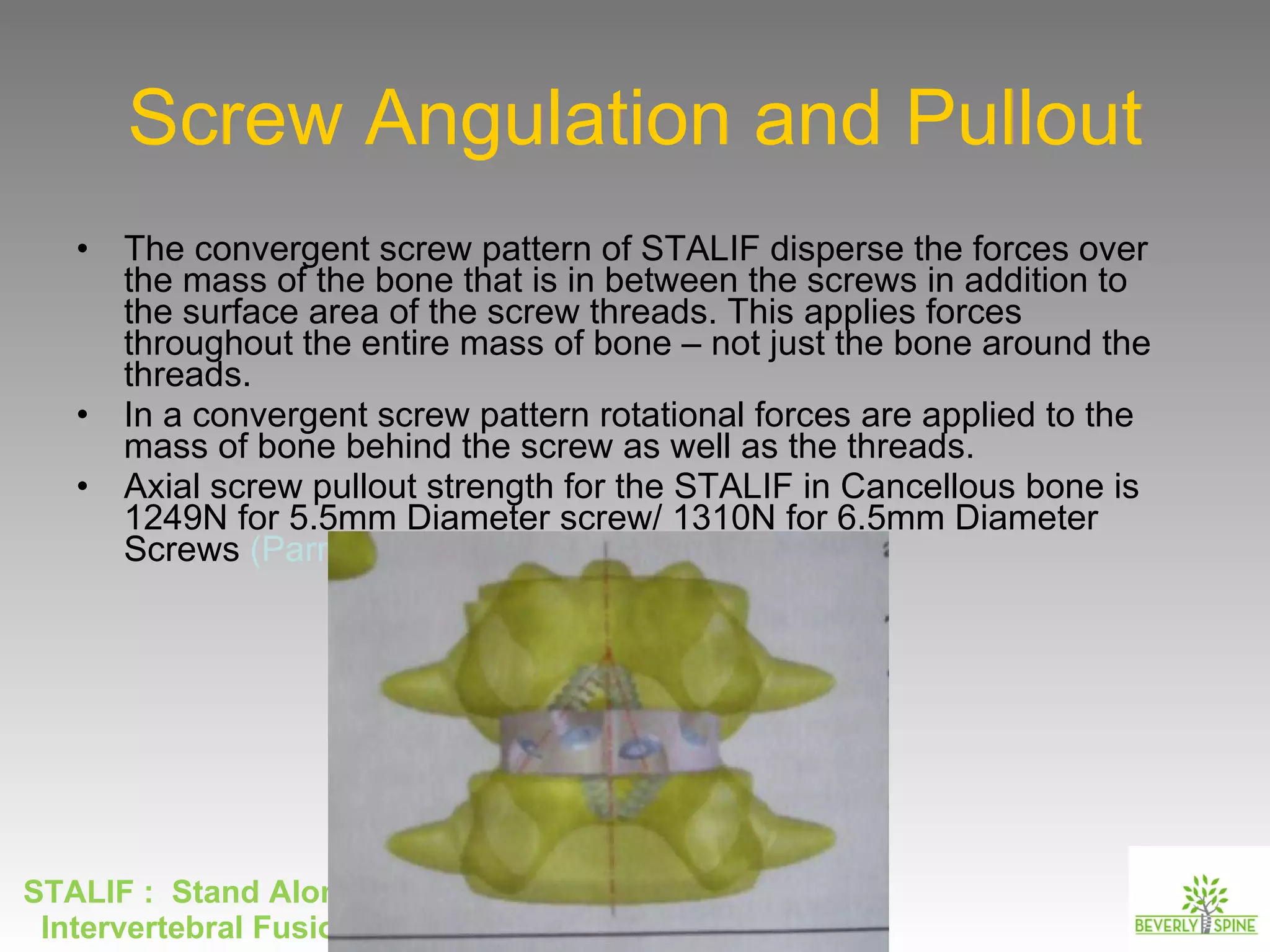 Lumbar Fusion : A New Anterior Only Option. The STALIF | PPT