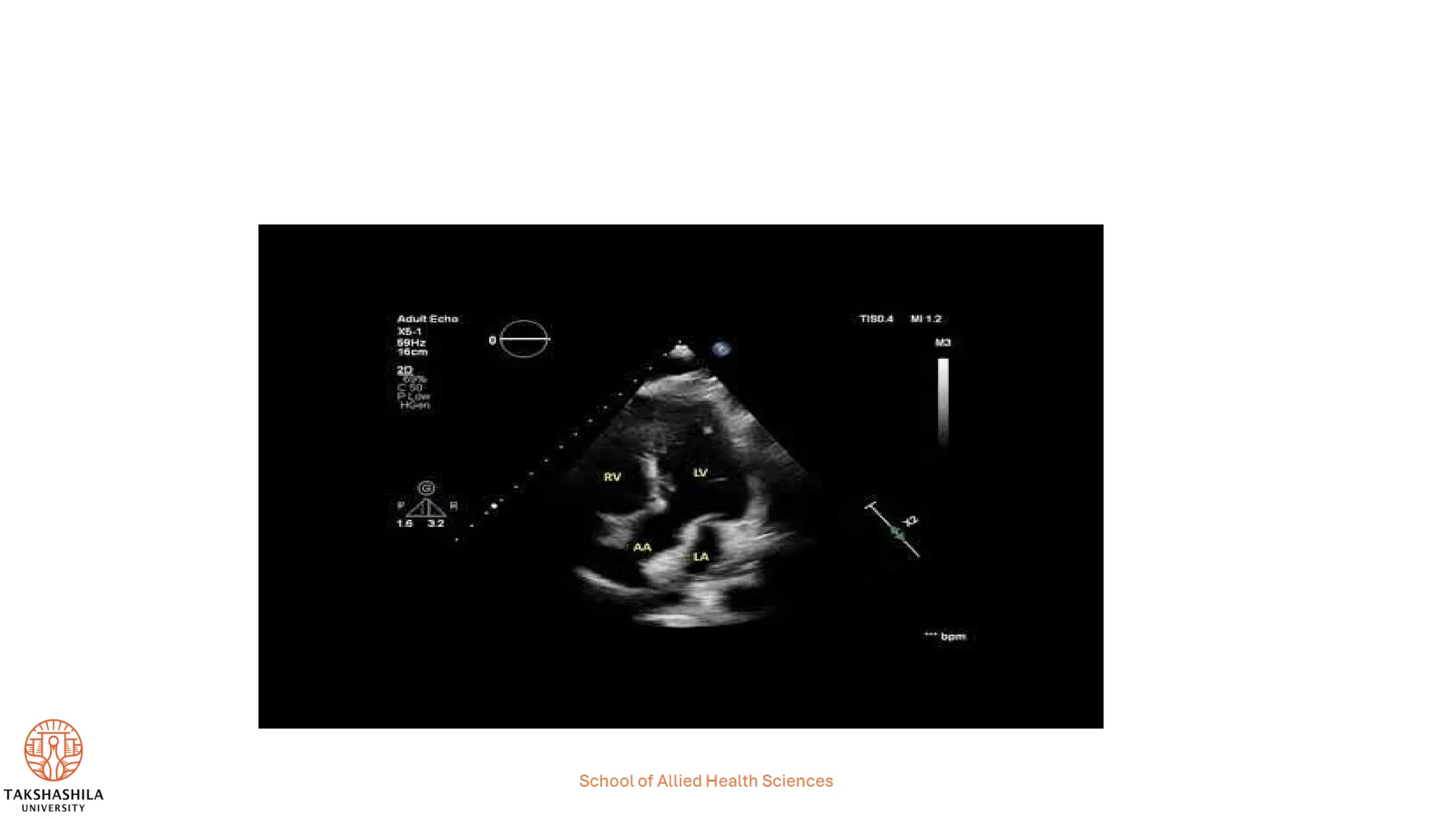 The standard echocardiography windows.pptx