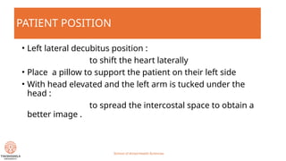The standard echocardiography windows.pptx