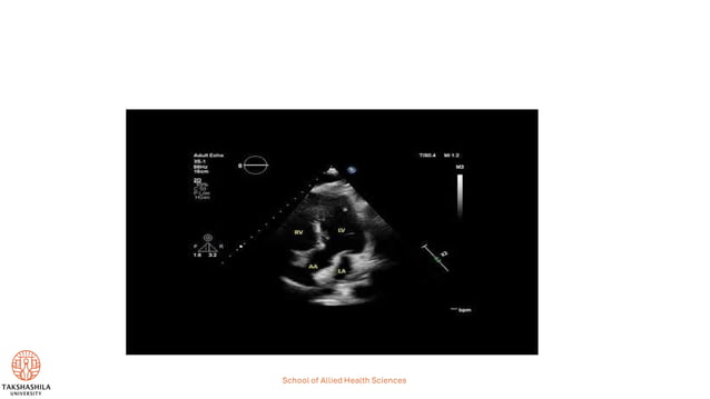 The standard echocardiography windows.pptx