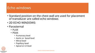 The standard echocardiography windows.pptx