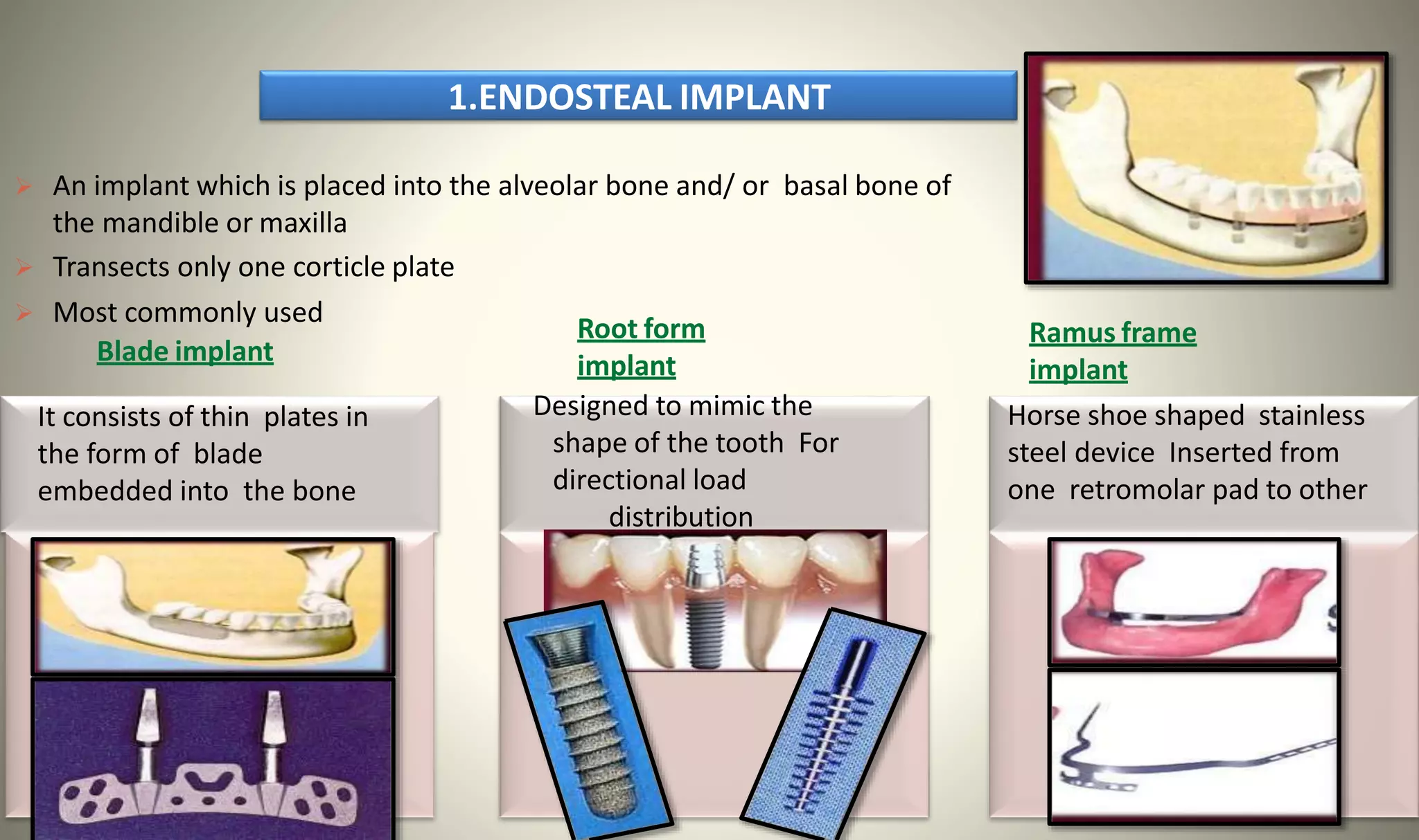 Standard implant surgical procedure.pptx