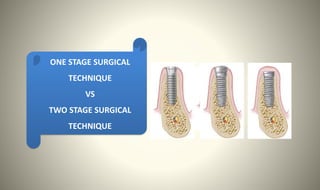 Standard implant surgical procedure.pptx