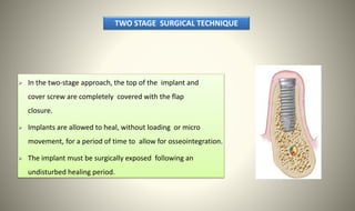 Standard implant surgical procedure.pptx