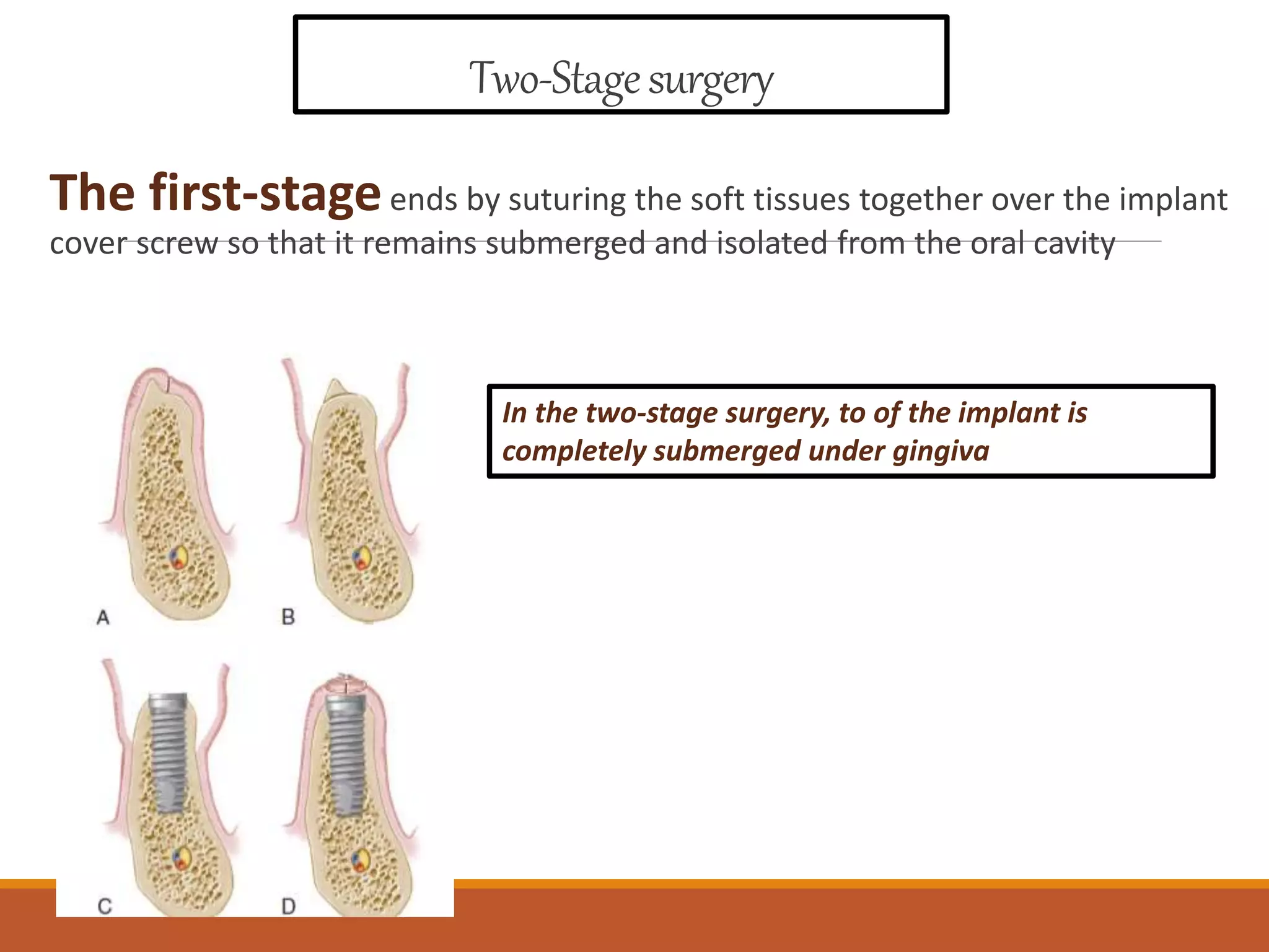Standard implant surgical procedures | PPTX