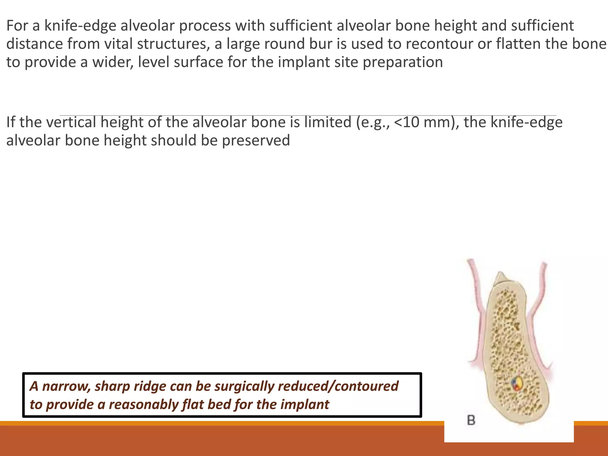 Standard implant surgical procedures | PPTX
