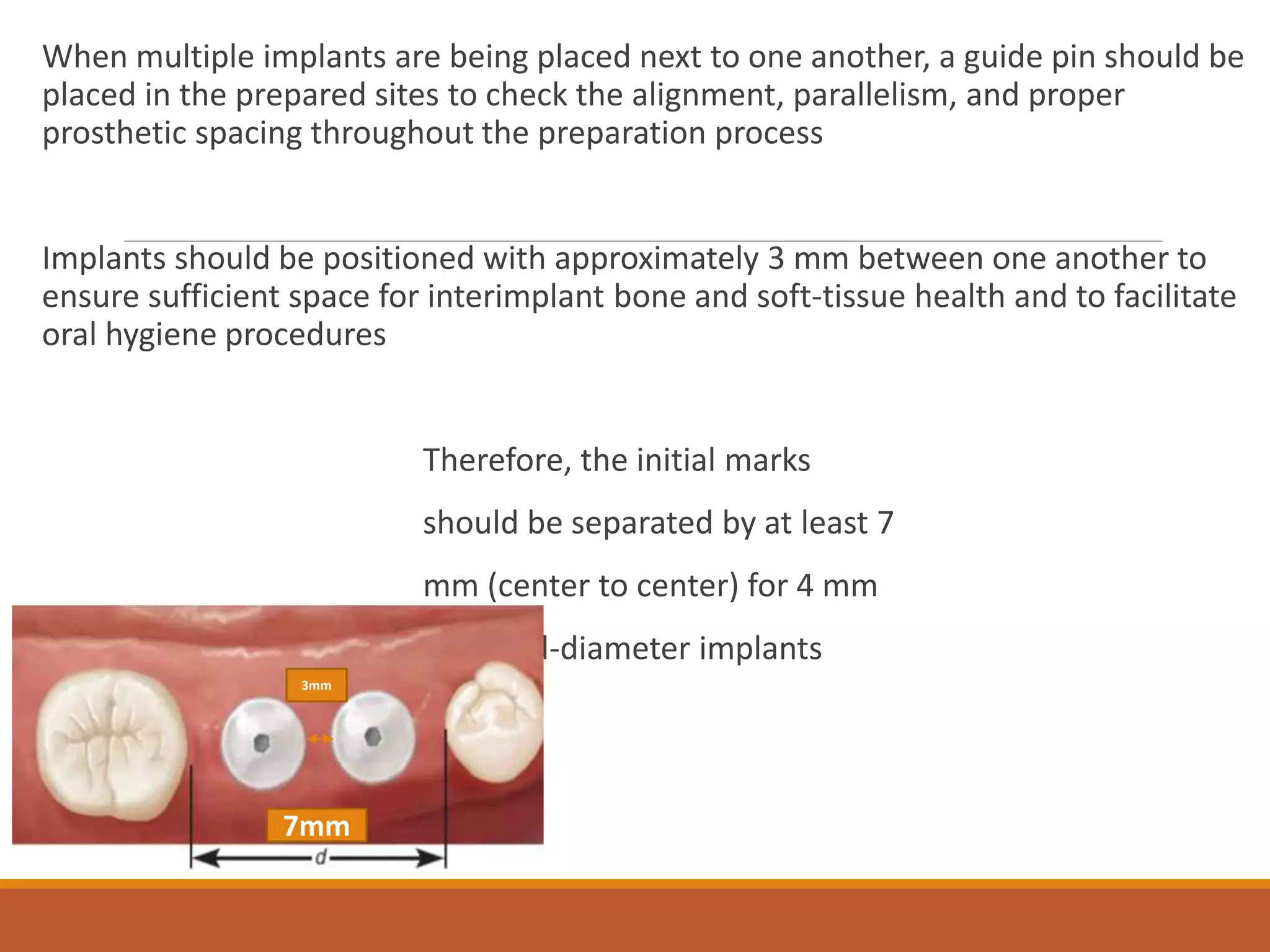Standard implant surgical procedures | PPTX
