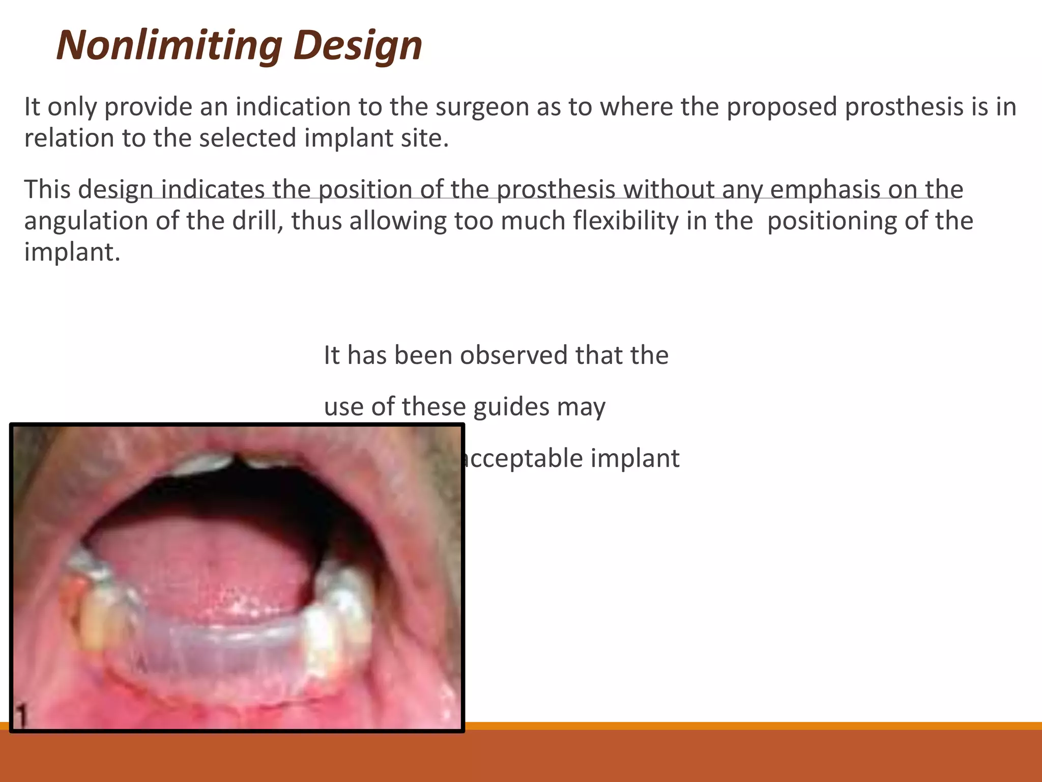 Standard implant surgical procedures | PPTX
