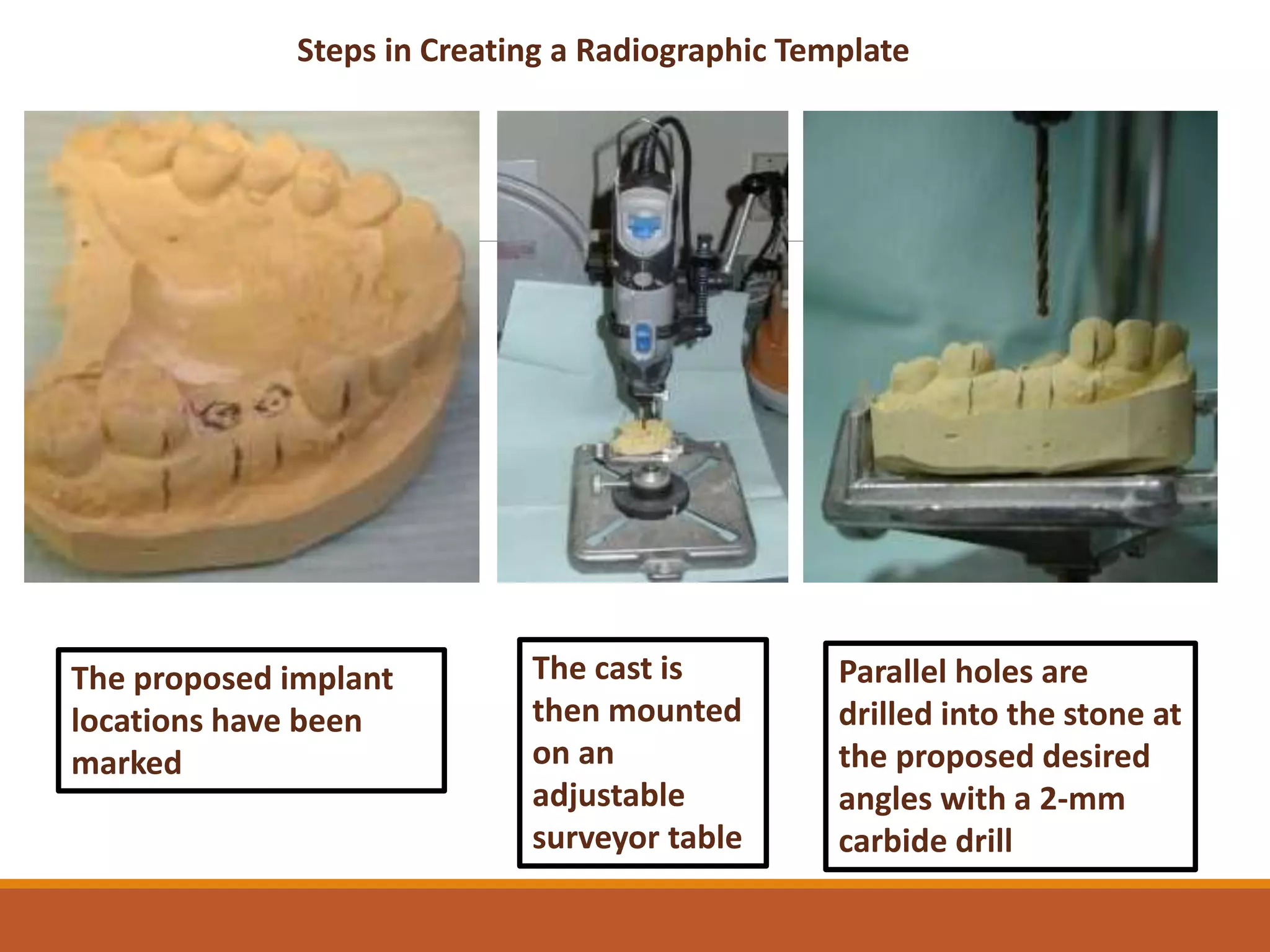 Standard implant surgical procedures | PPTX