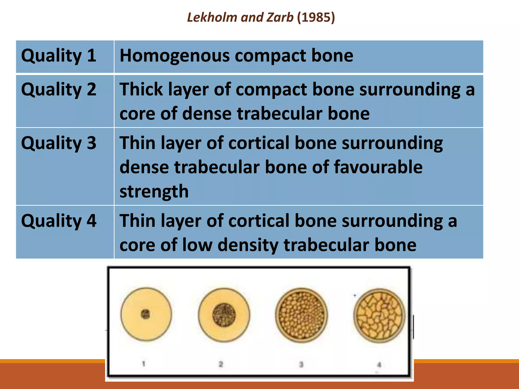 Standard implant surgical procedures | PPTX