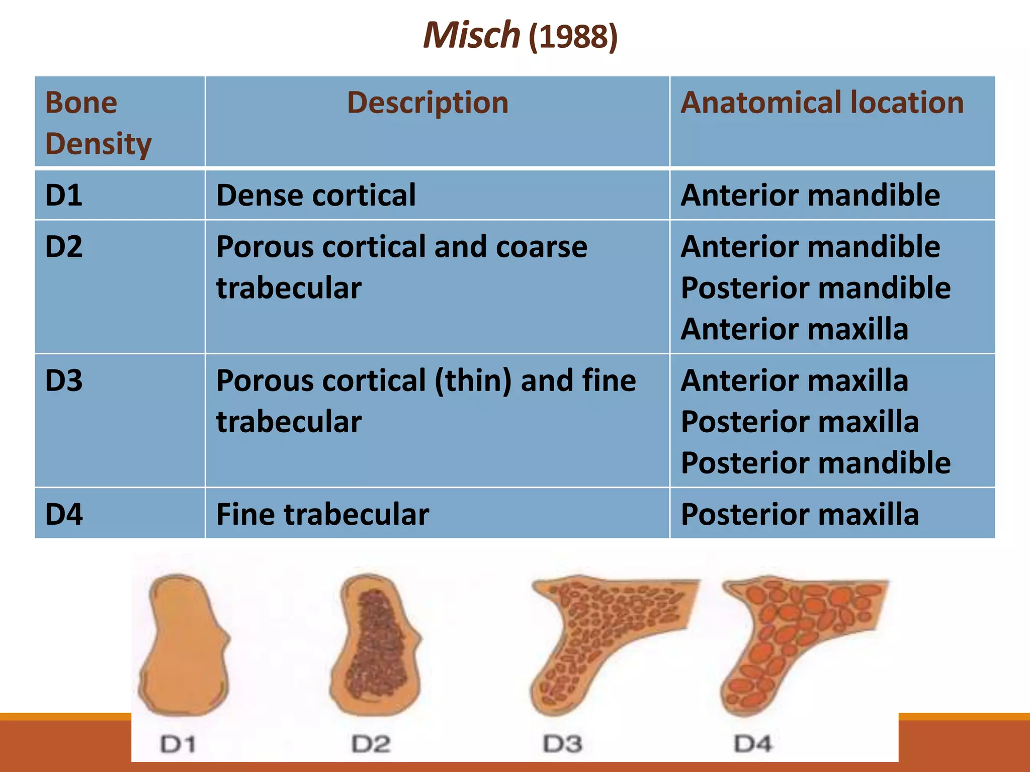 Standard implant surgical procedures | PPTX