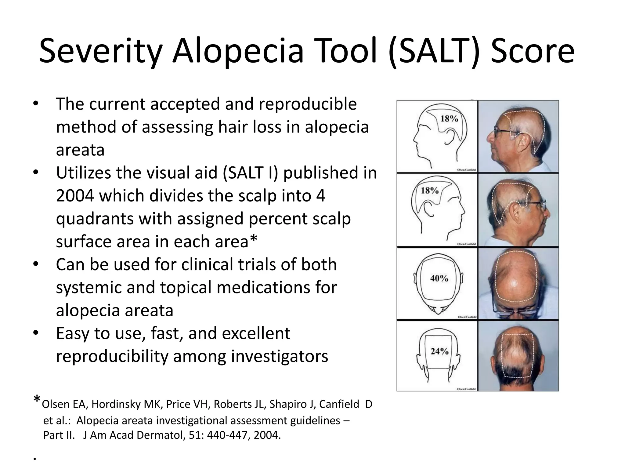 Standardizing Outcome Measures in Alopecia Areata | PDF