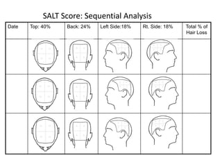 Standardizing Outcome Measures in Alopecia Areata | PDF | Skin and ...