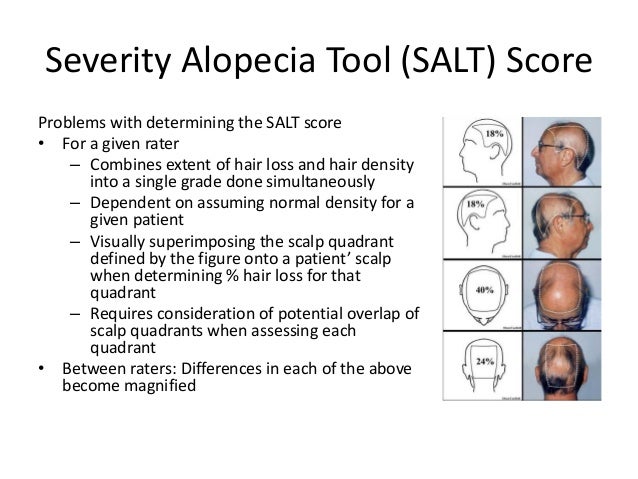 Standardizing Outcome Measures in Alopecia Areata