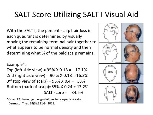 Standardizing Outcome Measures in Alopecia Areata