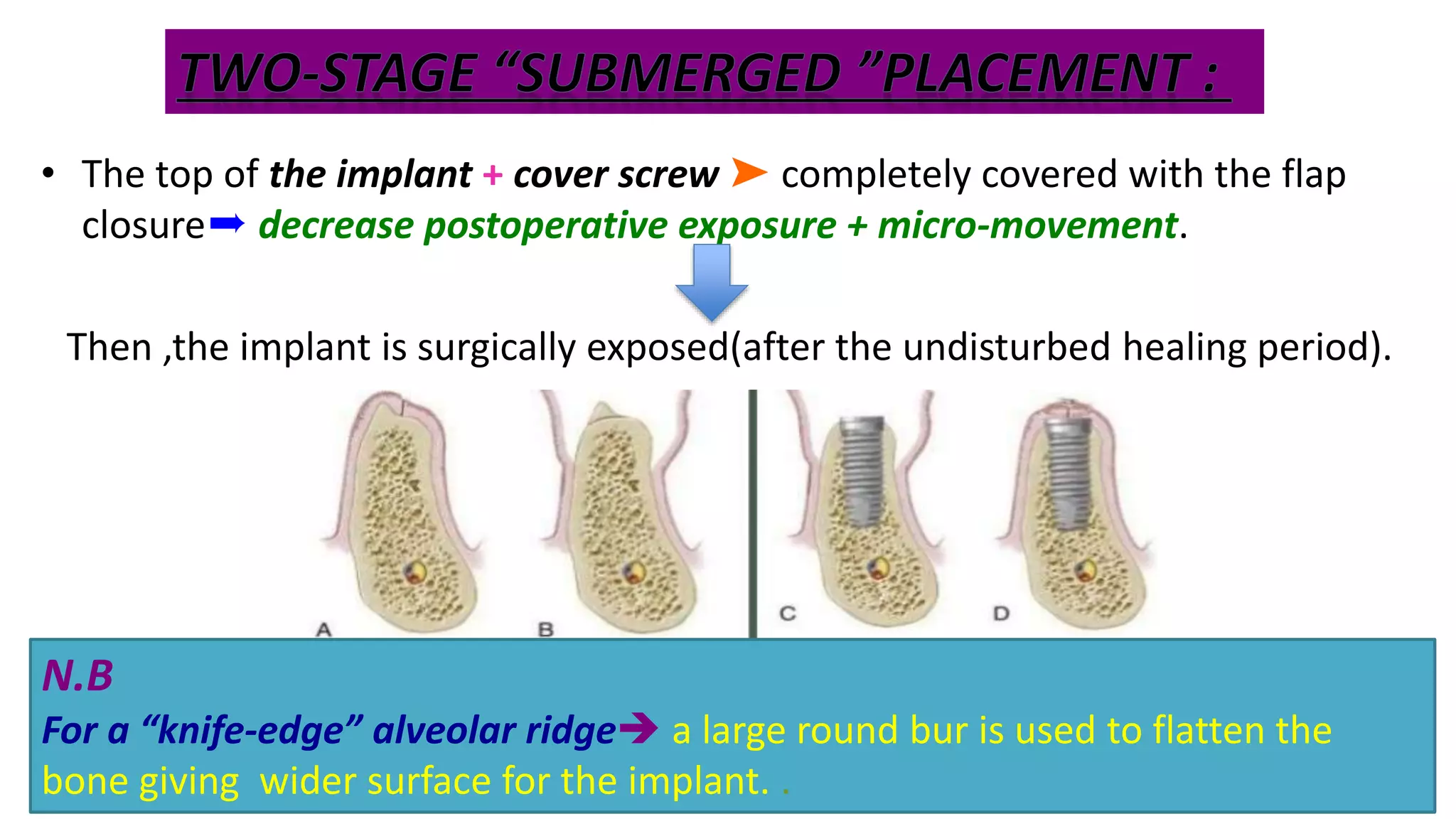 Standard surgical procedure for implant placement | PPTX
