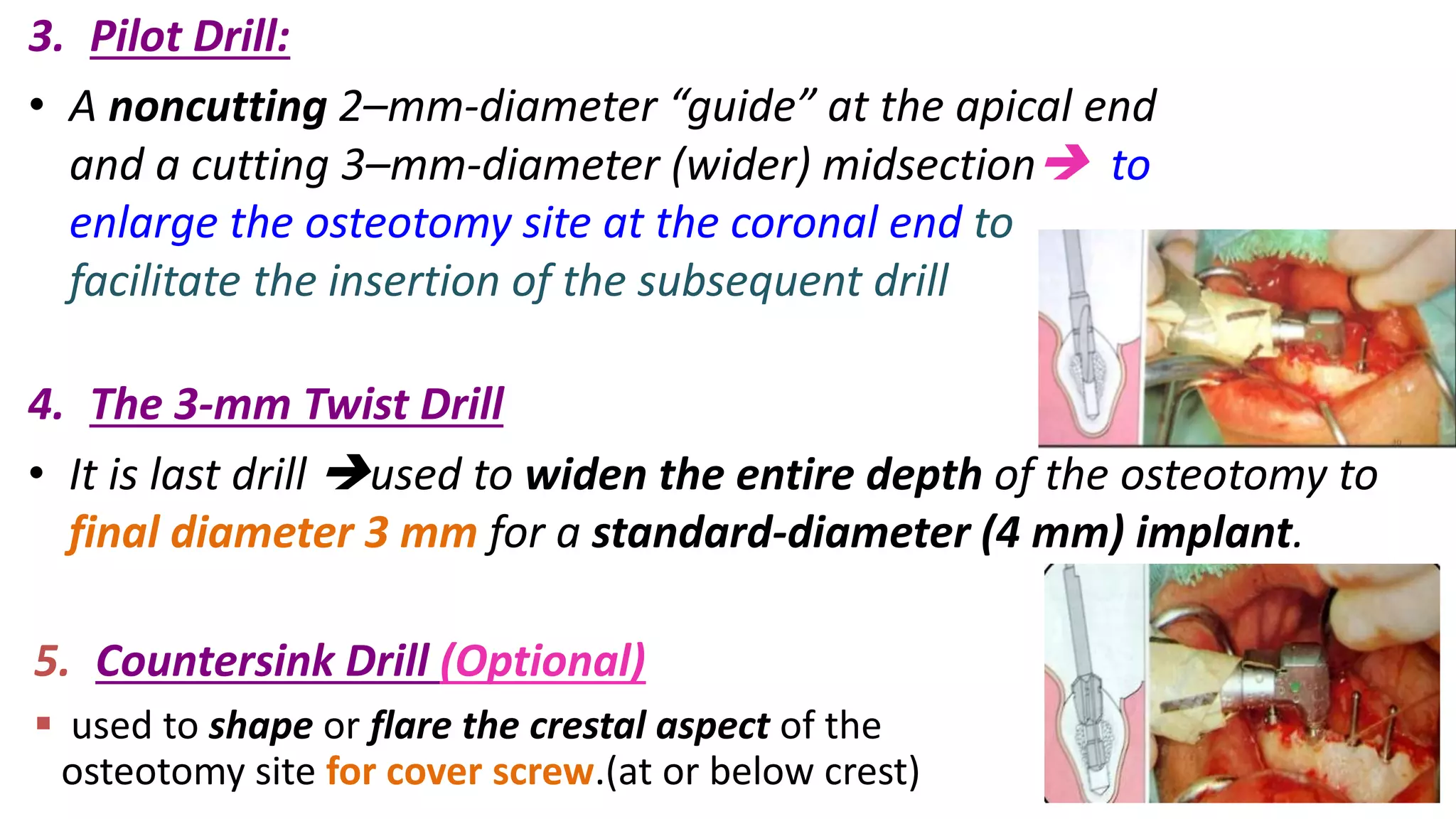 Standard surgical procedure for implant placement | PPTX