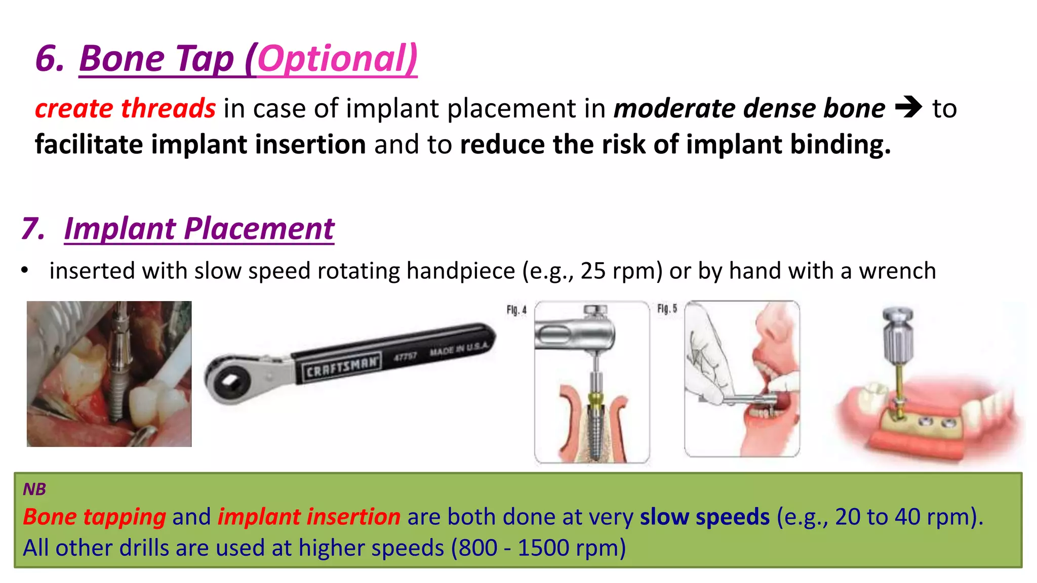 Standard surgical procedure for implant placement | PPTX