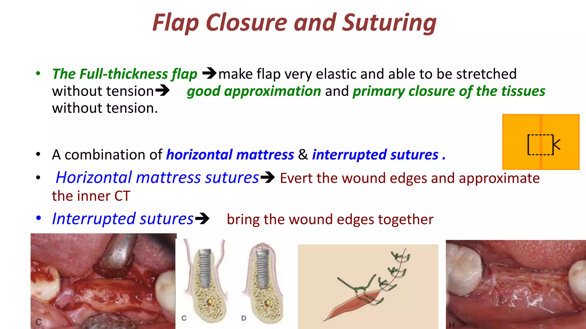 Standard surgical procedure for implant placement | PPTX