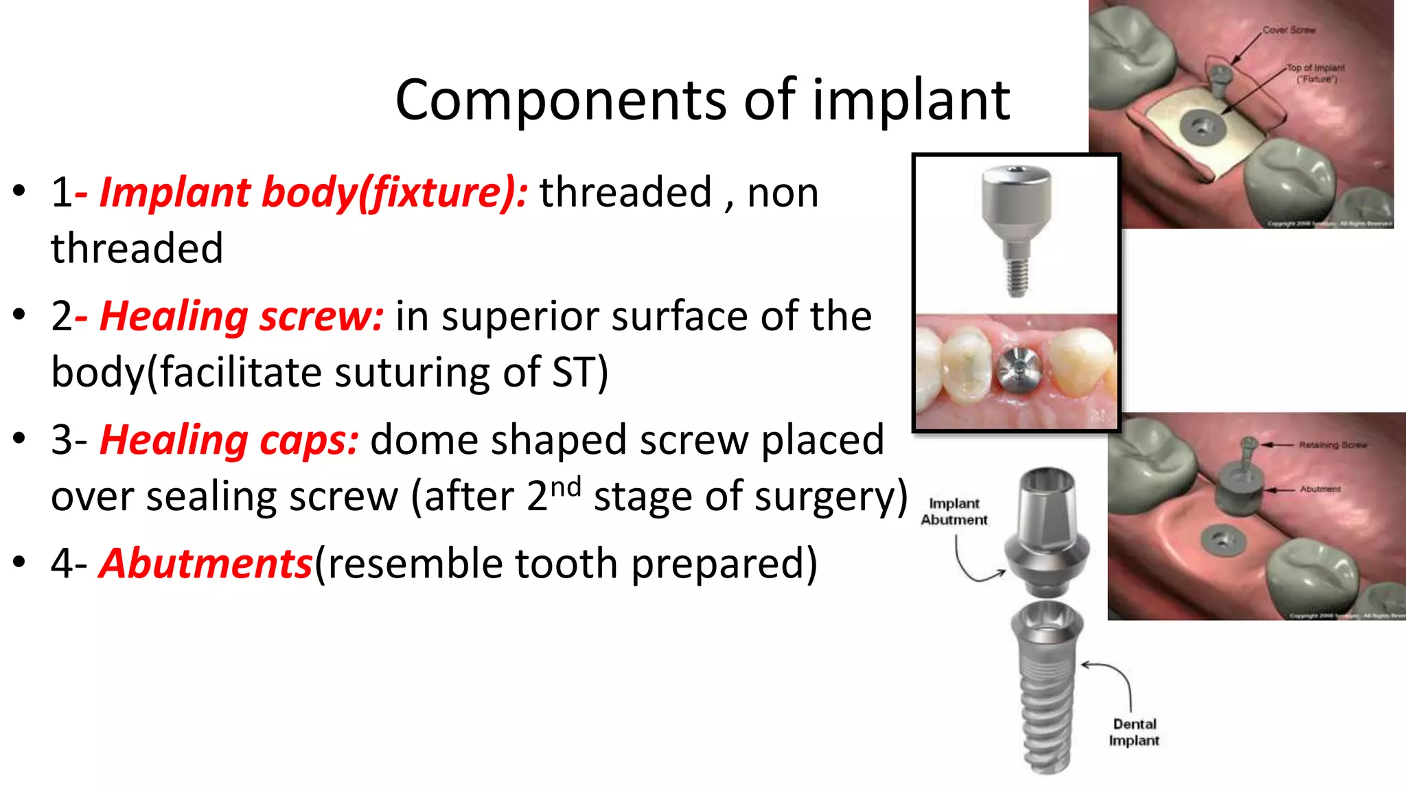 Standard surgical procedure for implant placement | PPTX