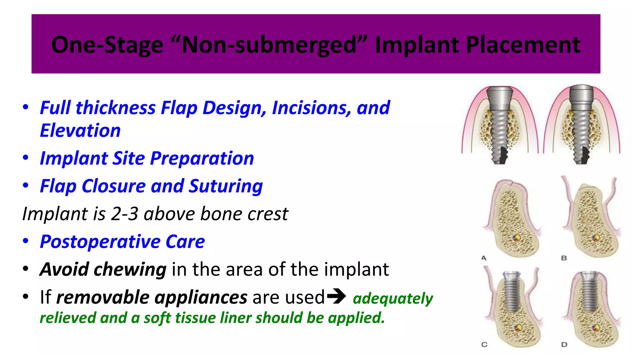 Standard surgical procedure for implant placement | PPTX