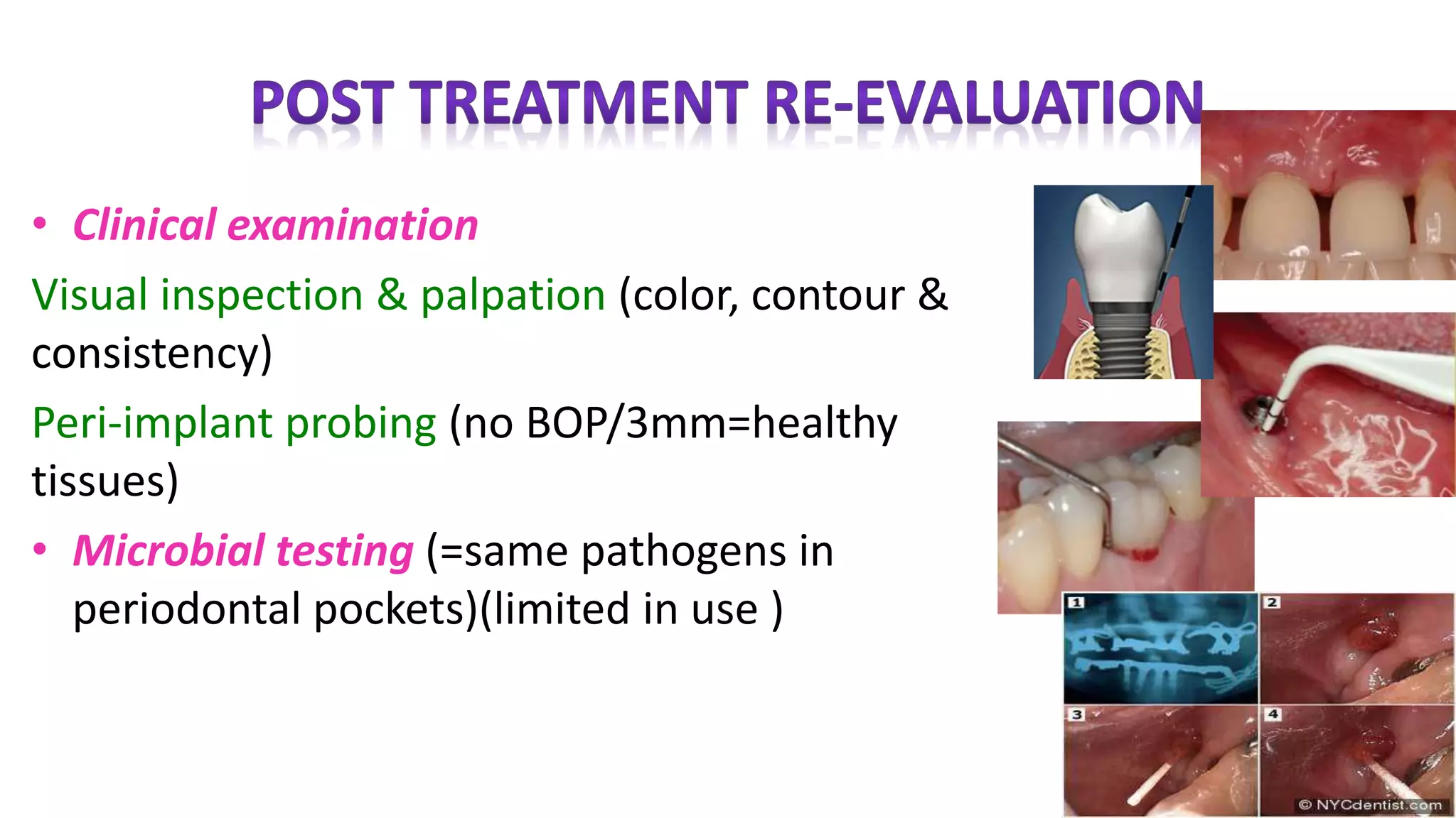 Standard surgical procedure for implant placement | PPTX