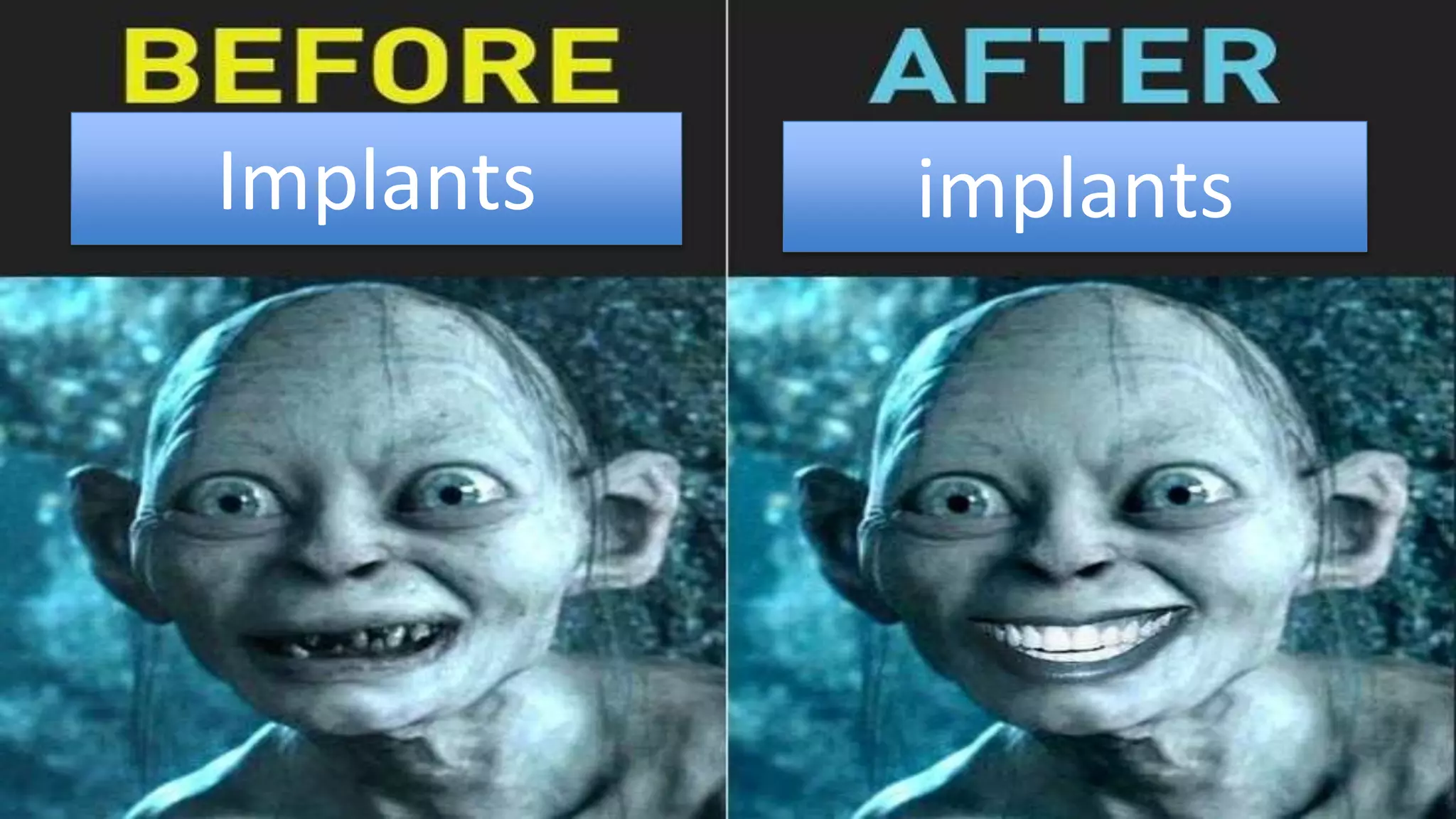 Standard surgical procedure for implant placement | PPTX