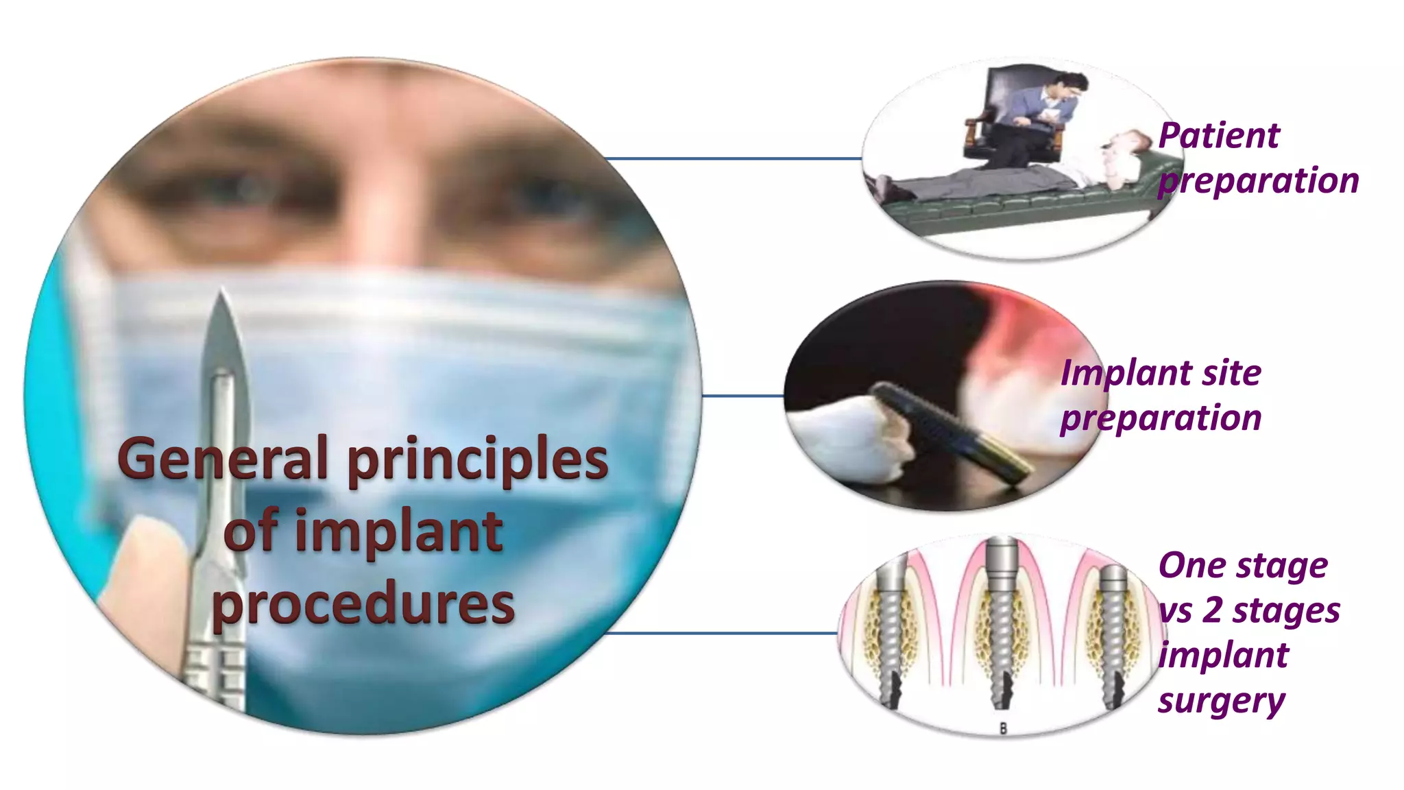 Standard surgical procedure for implant placement | PPTX
