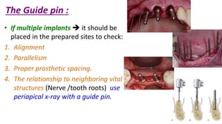 Standard surgical procedure for implant placement | PPTX