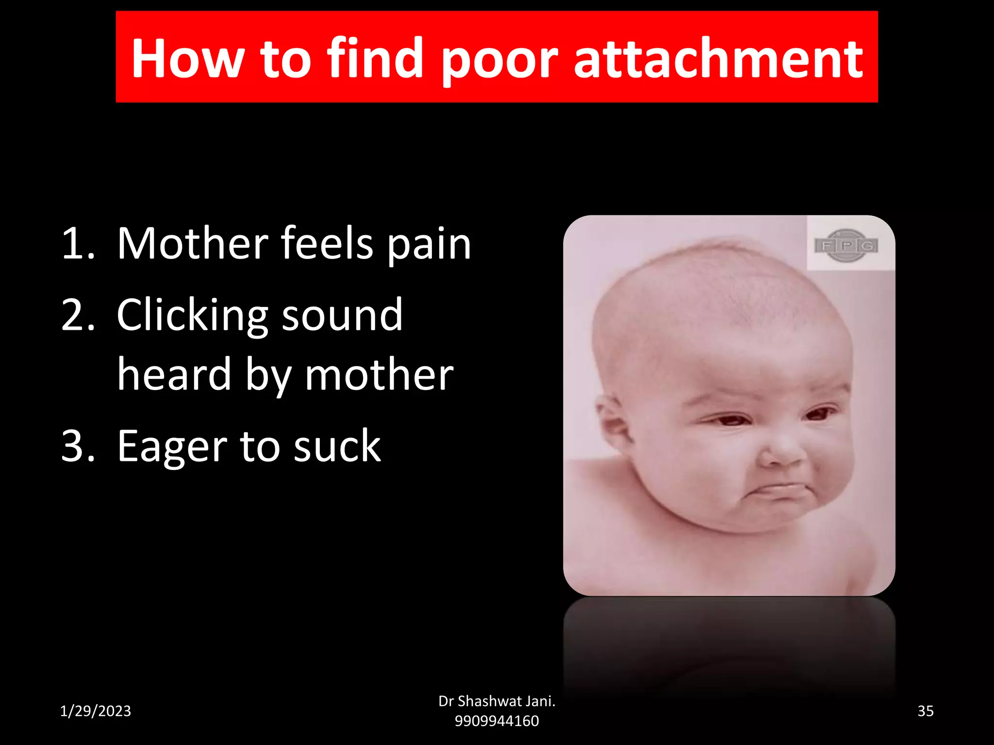 STANDARD TECHNIQUES OF BREAST FEEDING BY DR SHASHWAT JANI.pptx