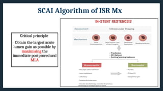 STENT THROMBOSIS AND IN STENT RESTENOSIS | PPTX