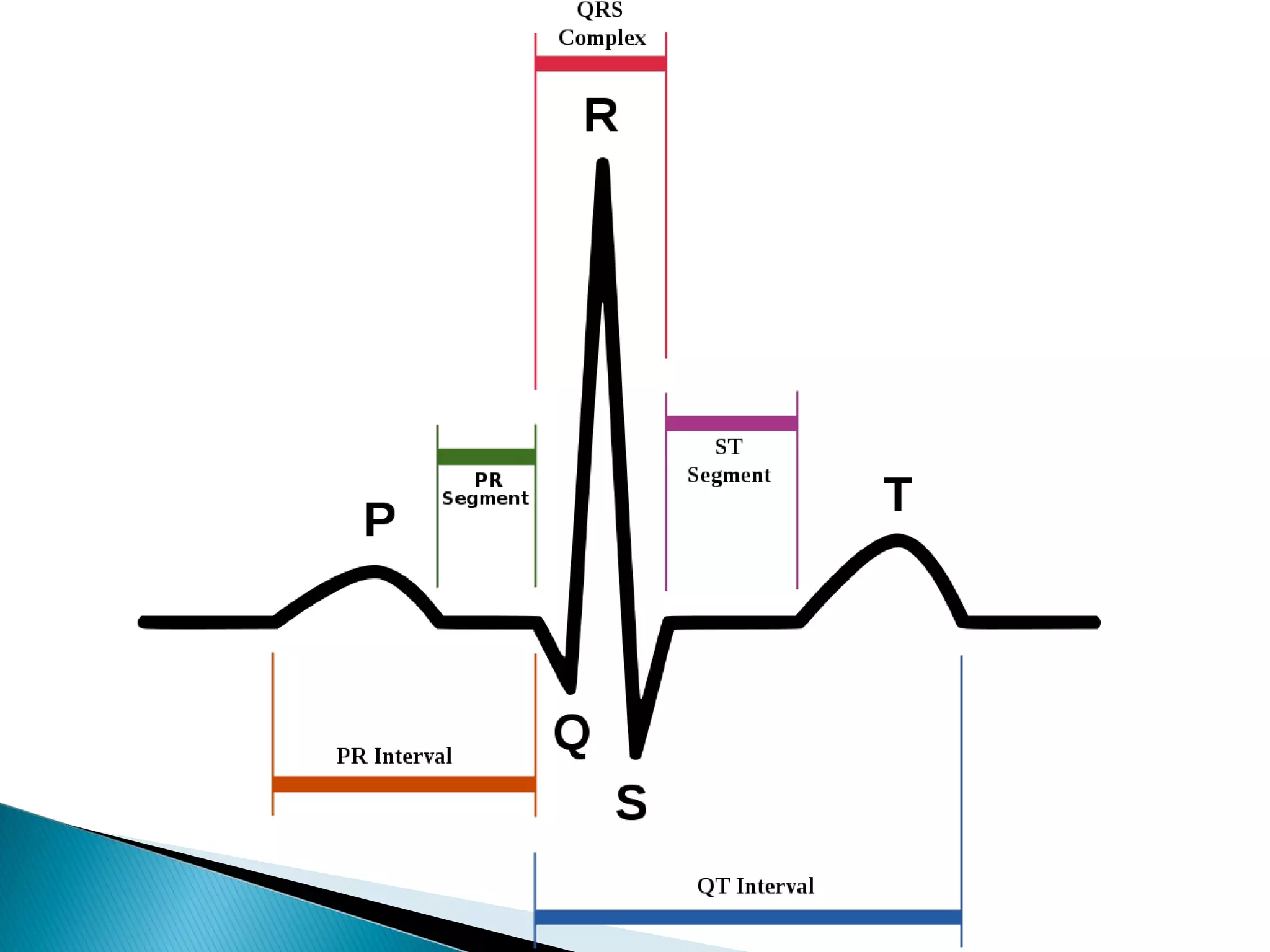 ST Segment Analysis (STAN) for Intrapartum Electronic Fetal Monitoring ...