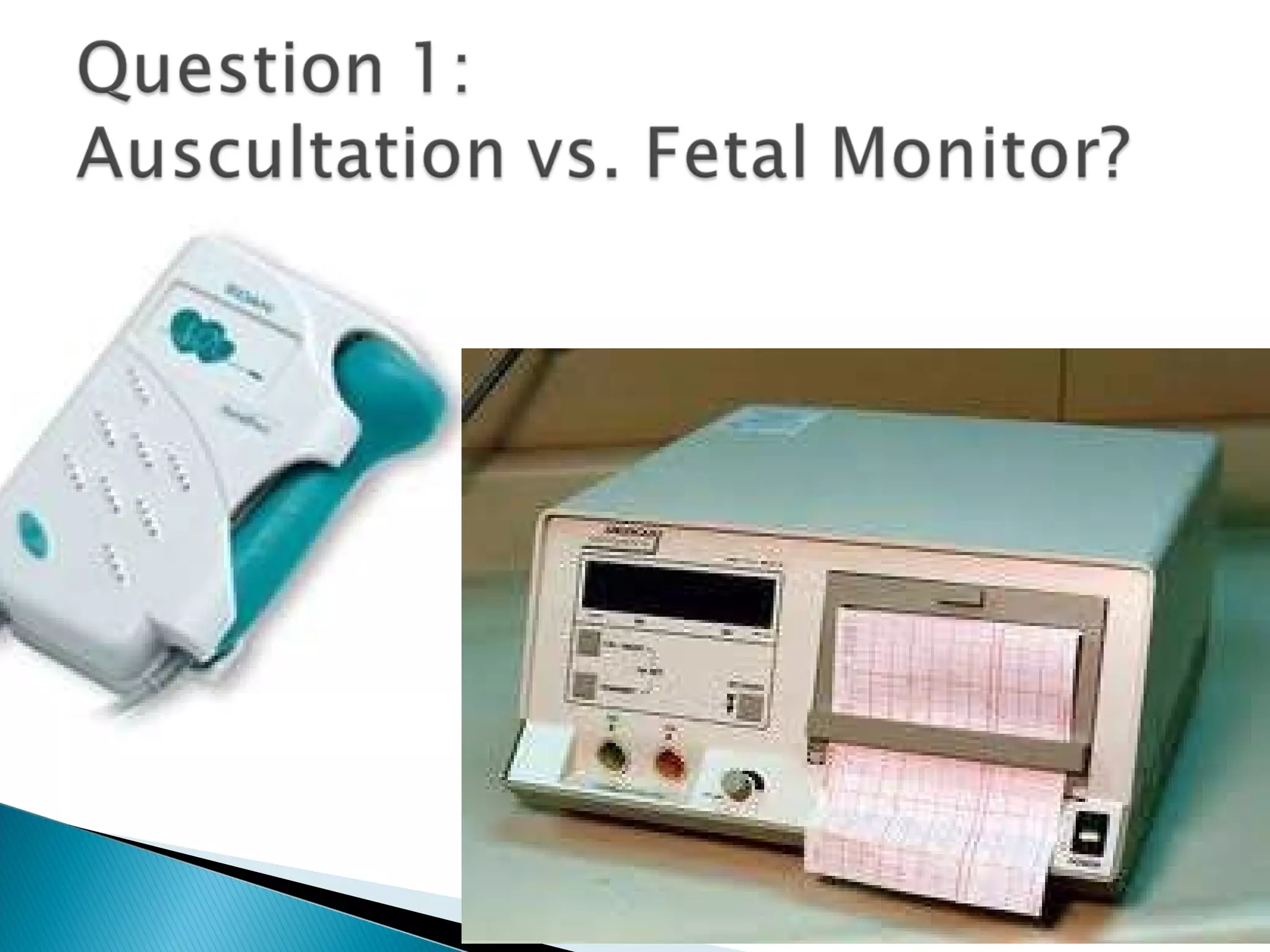 ST Segment Analysis (STAN) for Intrapartum Electronic Fetal Monitoring ...