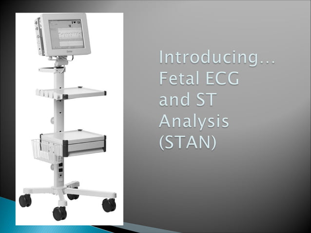 ST Segment Analysis (STAN) for Intrapartum Electronic Fetal Monitoring ...
