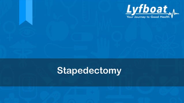 Stapedectomy | PPT