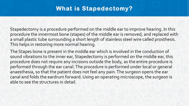 Stapedectomy | PPT