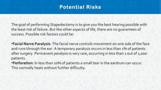 Stapedectomy | PPT