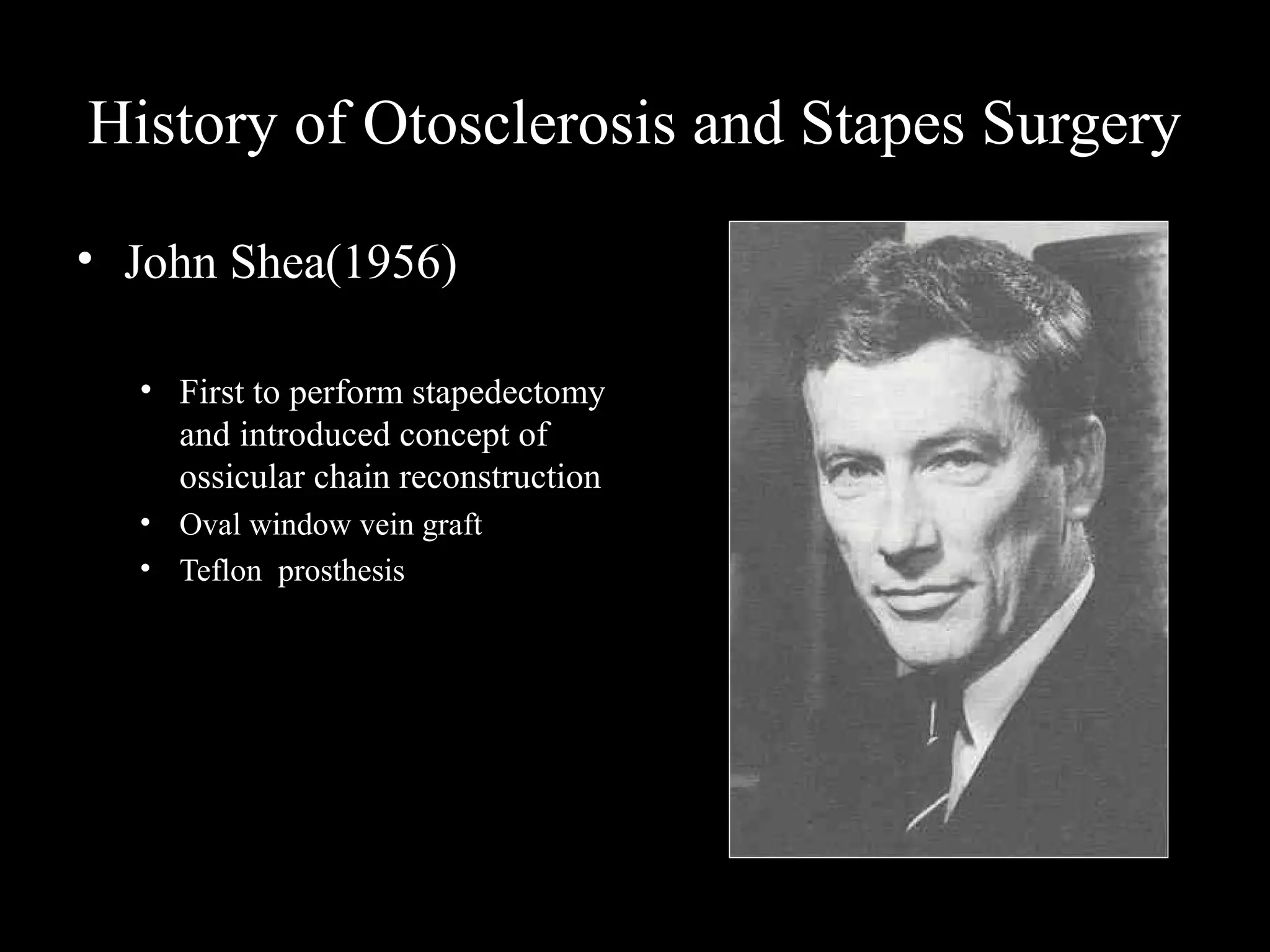 Stapes presentation | PPT