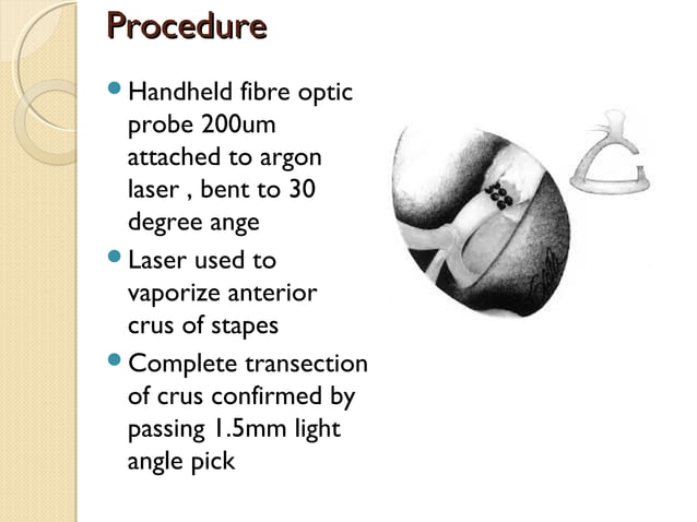surgical management of ototsclerosis | PPT